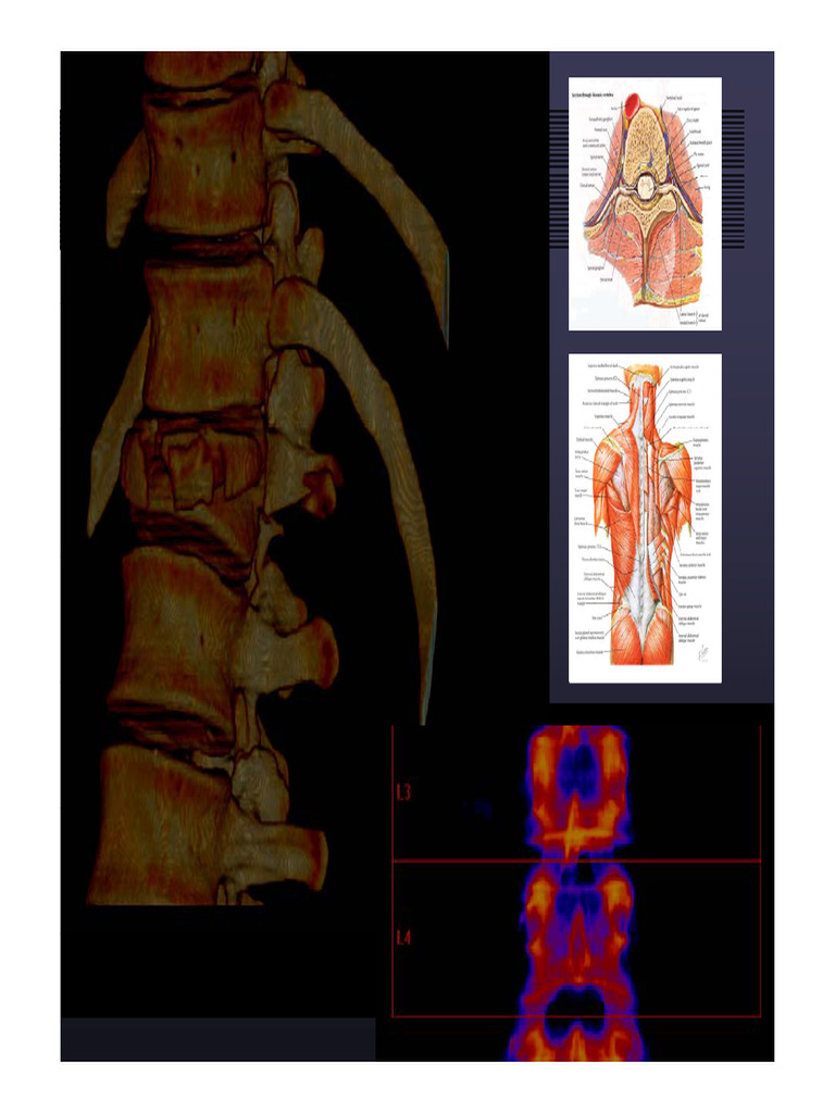 Lumbar Spine Examination Guide | PDF | Vertebra | Vertebral Column