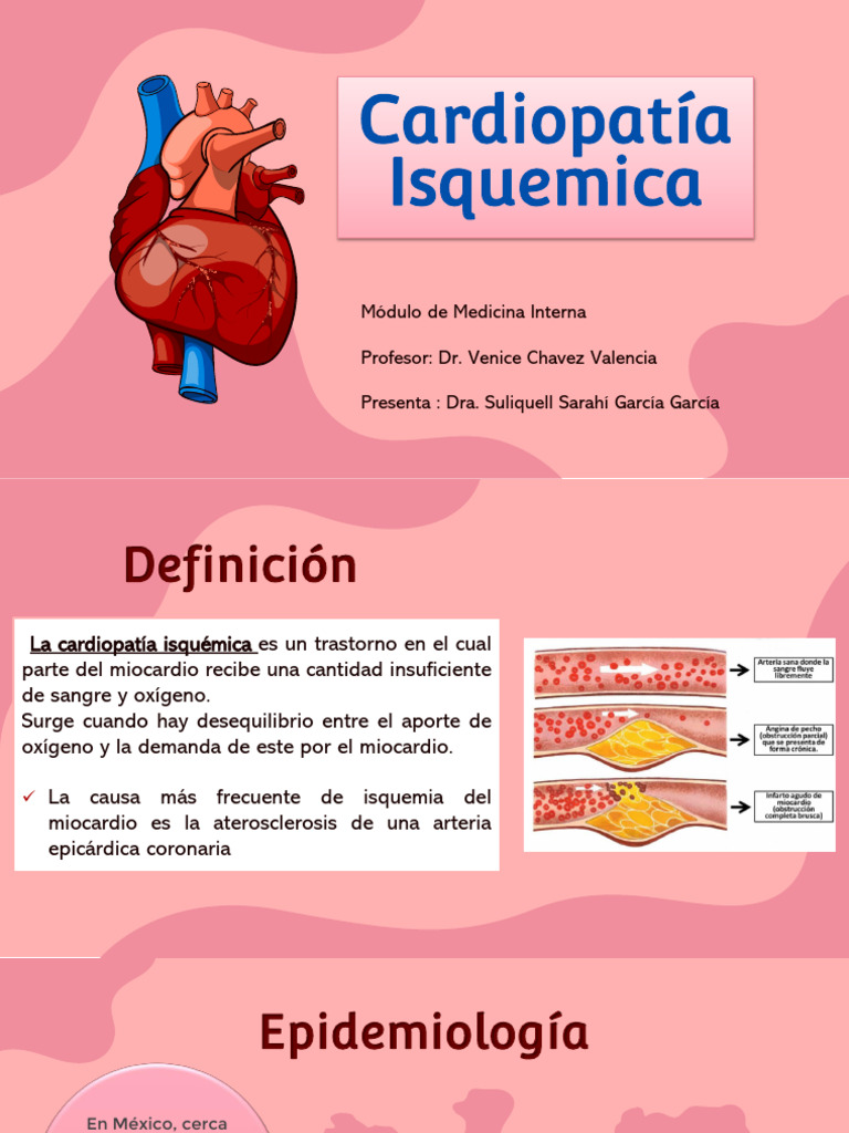 Cardiopatía Isquémica: Causas y Prevención | PDF | Infarto de miocardio ...