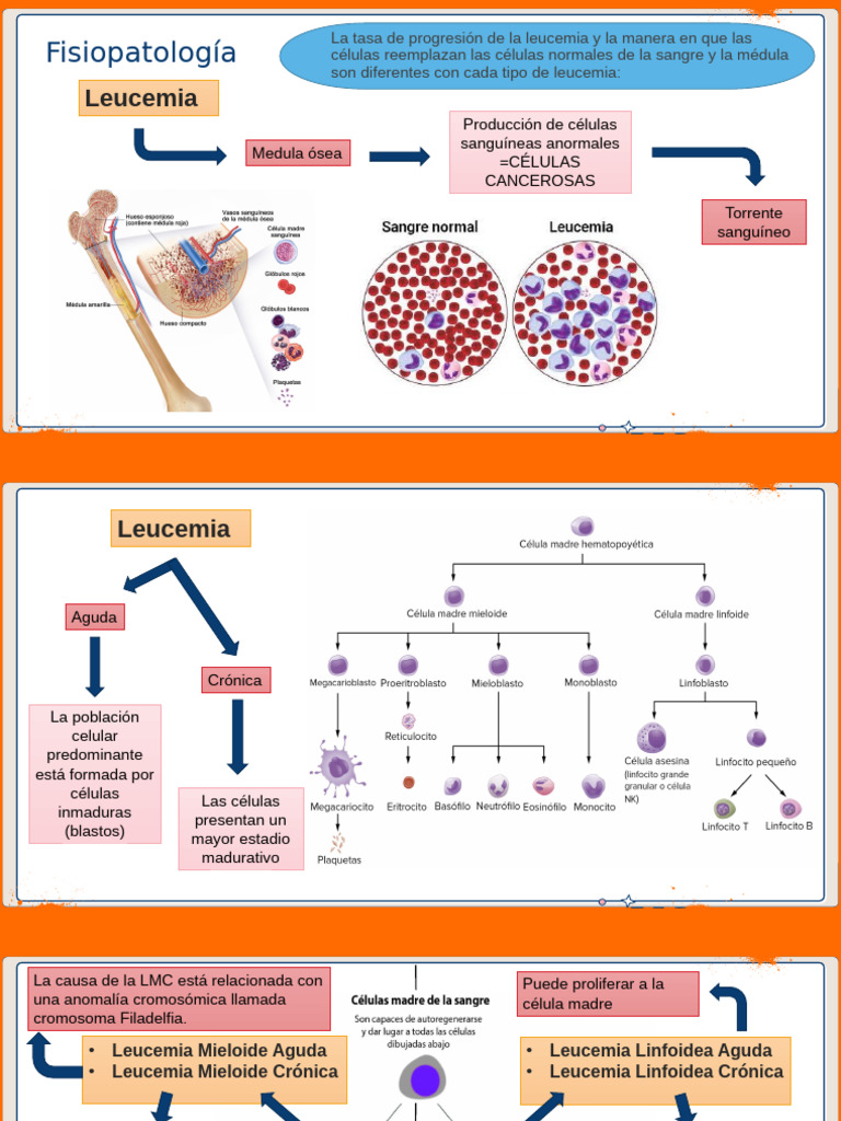 Fisiopatología Leucemia | PDF | Leucemia | Vertebrados