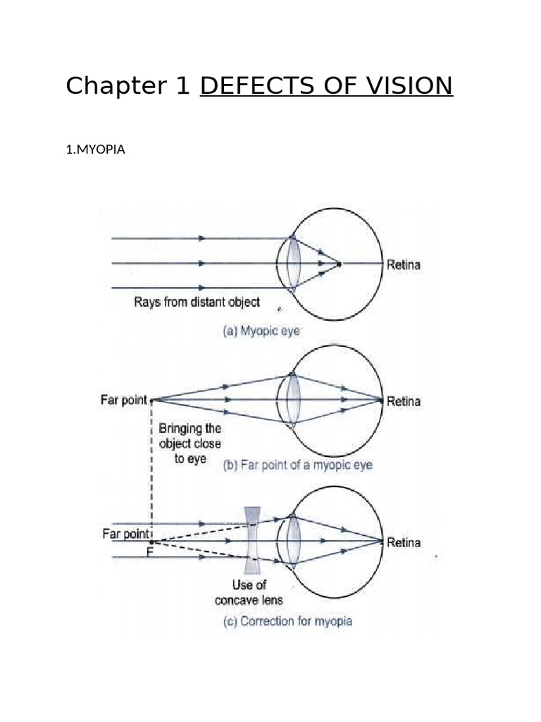 Myopia and Hypermetropia Explained | PDF | Sunset | Rainbow