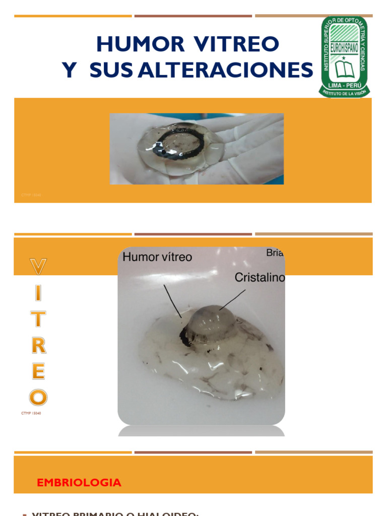 Clase 11 Humor Vitreo y Sus Alteraciones | PDF | Ojo humano