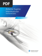 Stryker Exeter V40 Surgical Guide | PDF | Hip | Musculoskeletal System