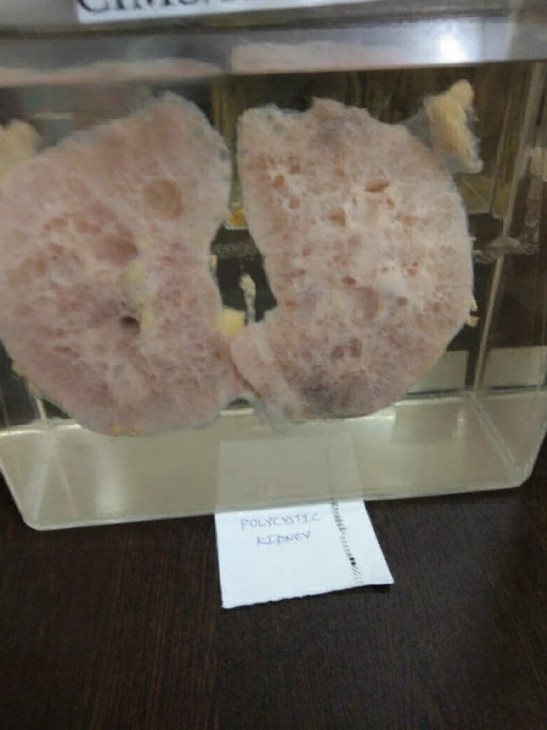 Patho Specimen Hims | PDF