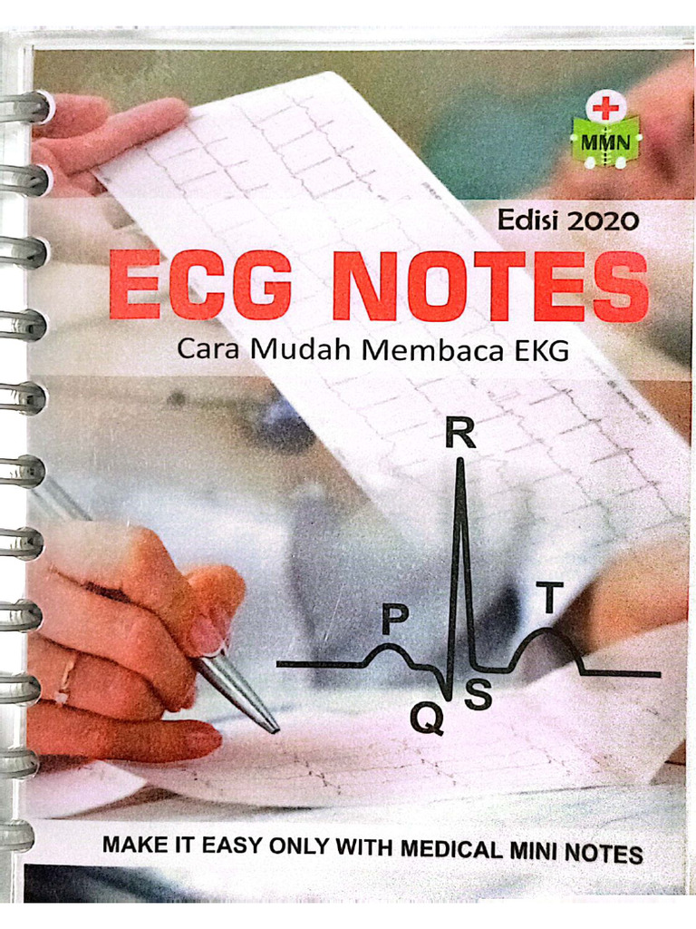 MMN Ecg Notes | PDF