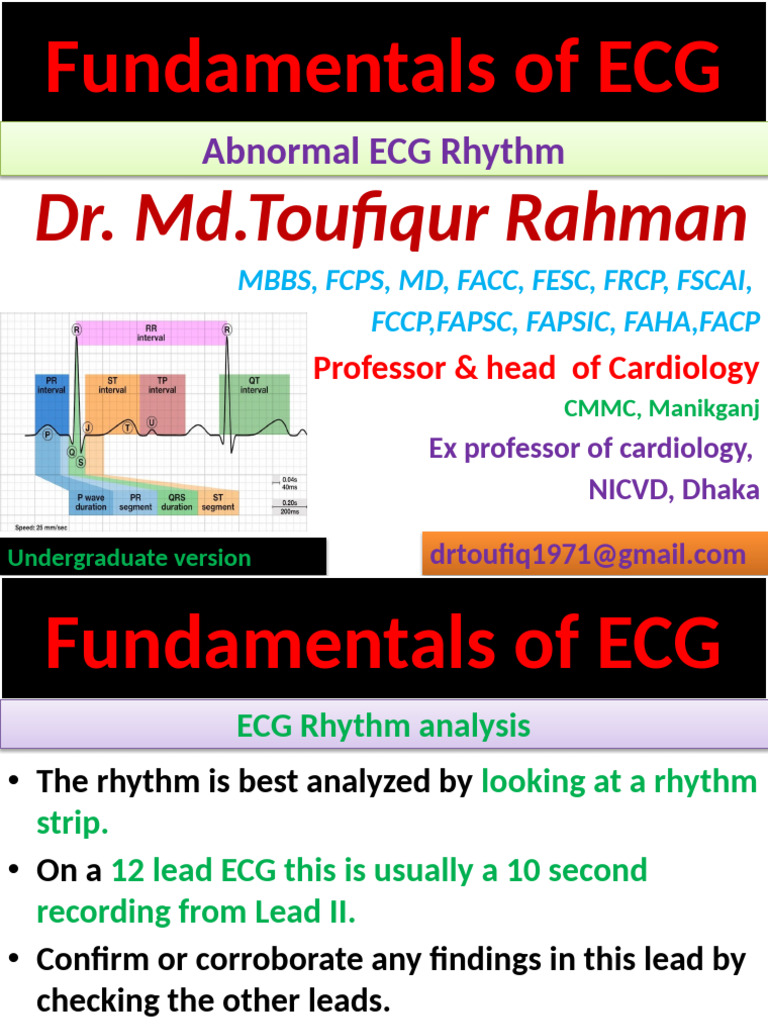 ECG Rhythm Analysis Fundamentals | PDF | Electrocardiography ...