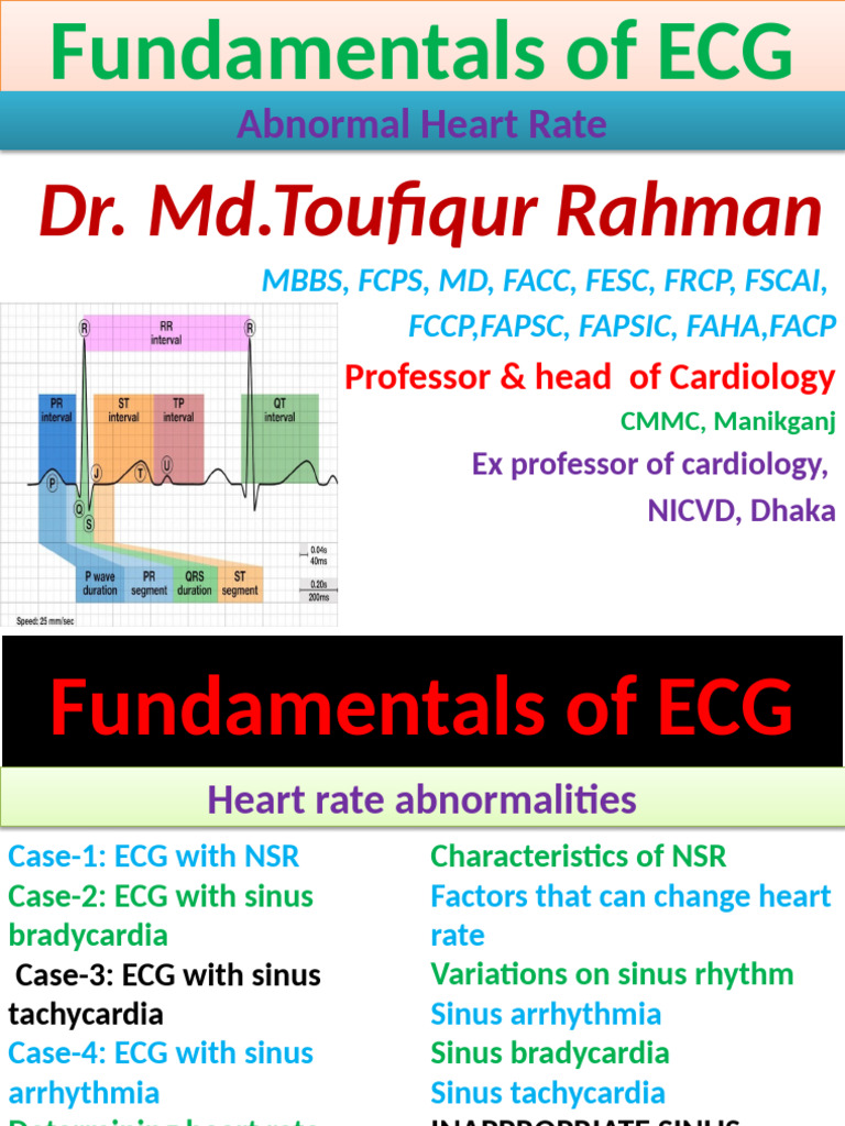 Heart Rate Abnormalty | PDF | Heart Rate | Electrocardiography