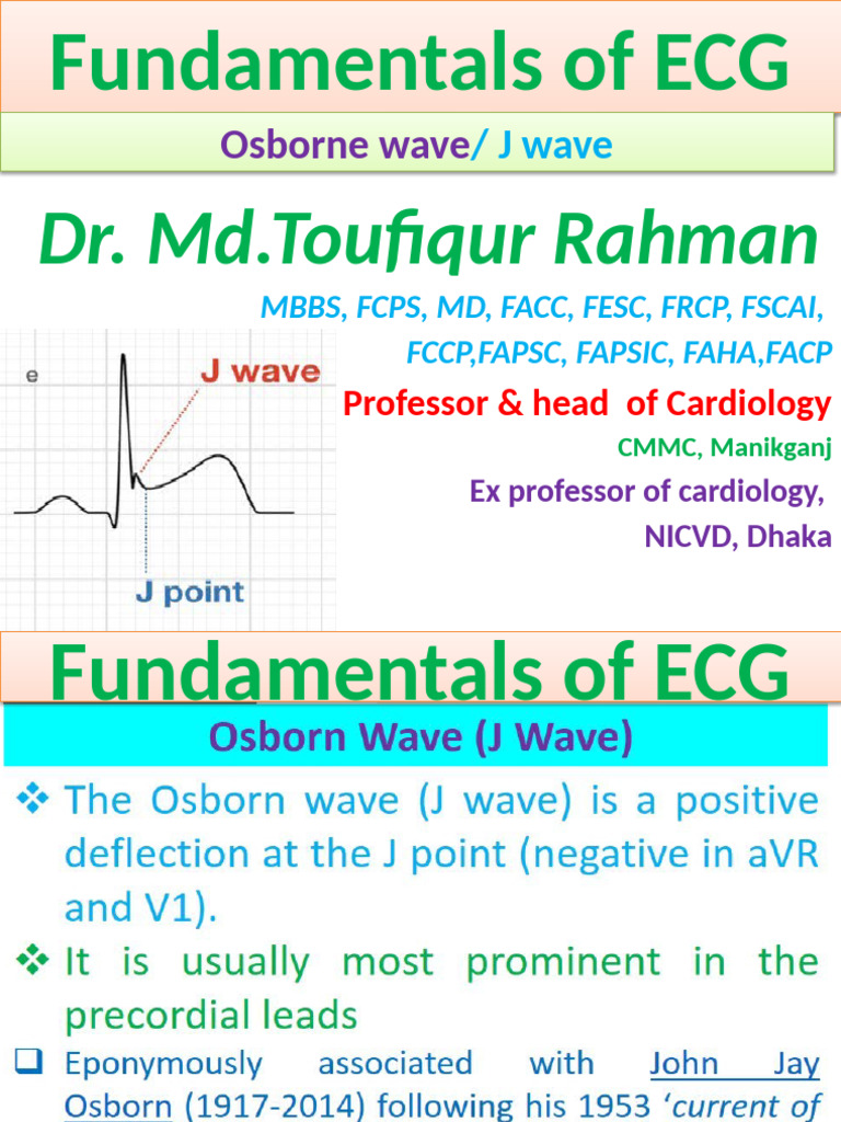 Osborne Wave and Jpoint | PDF