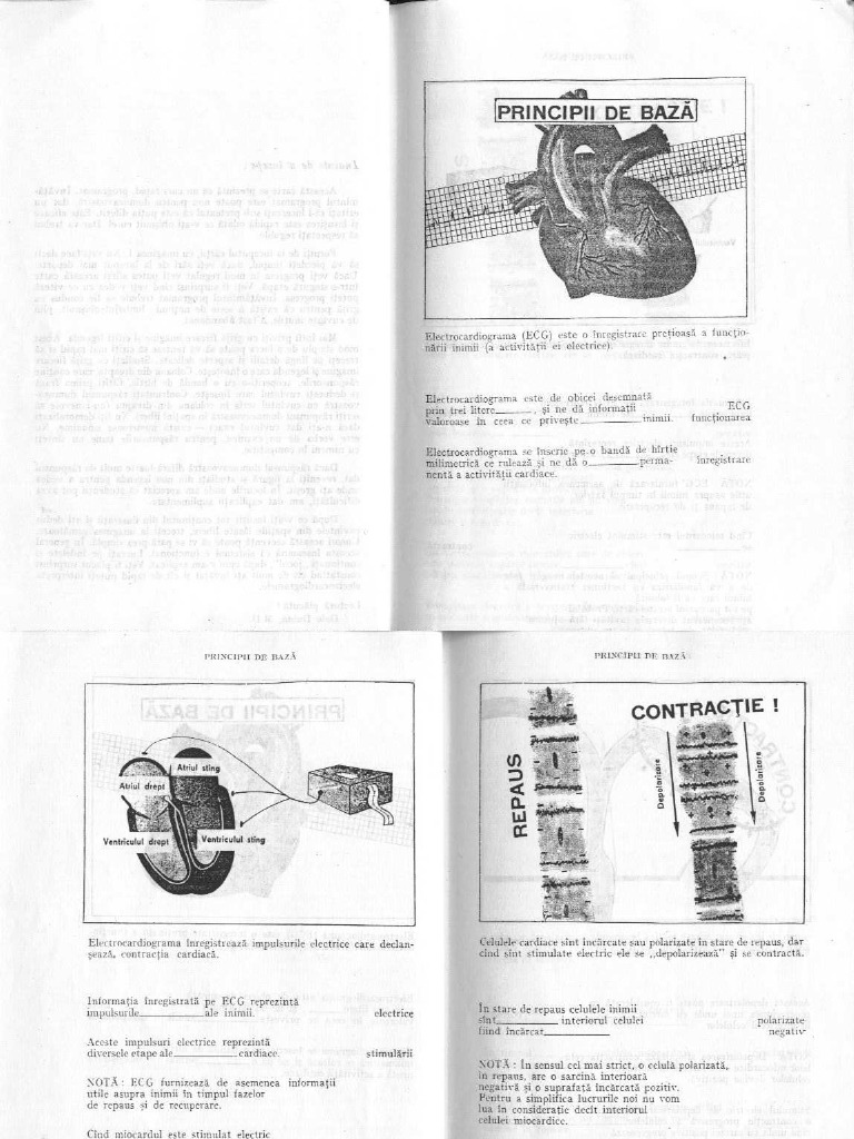 Interpretarea Rapida A ECG Dale Dubin | PDF
