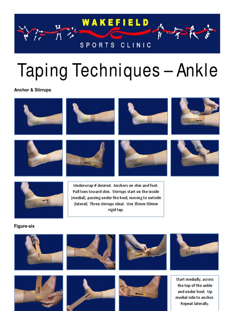 Taping Techniques Ankle | PDF | Wellness