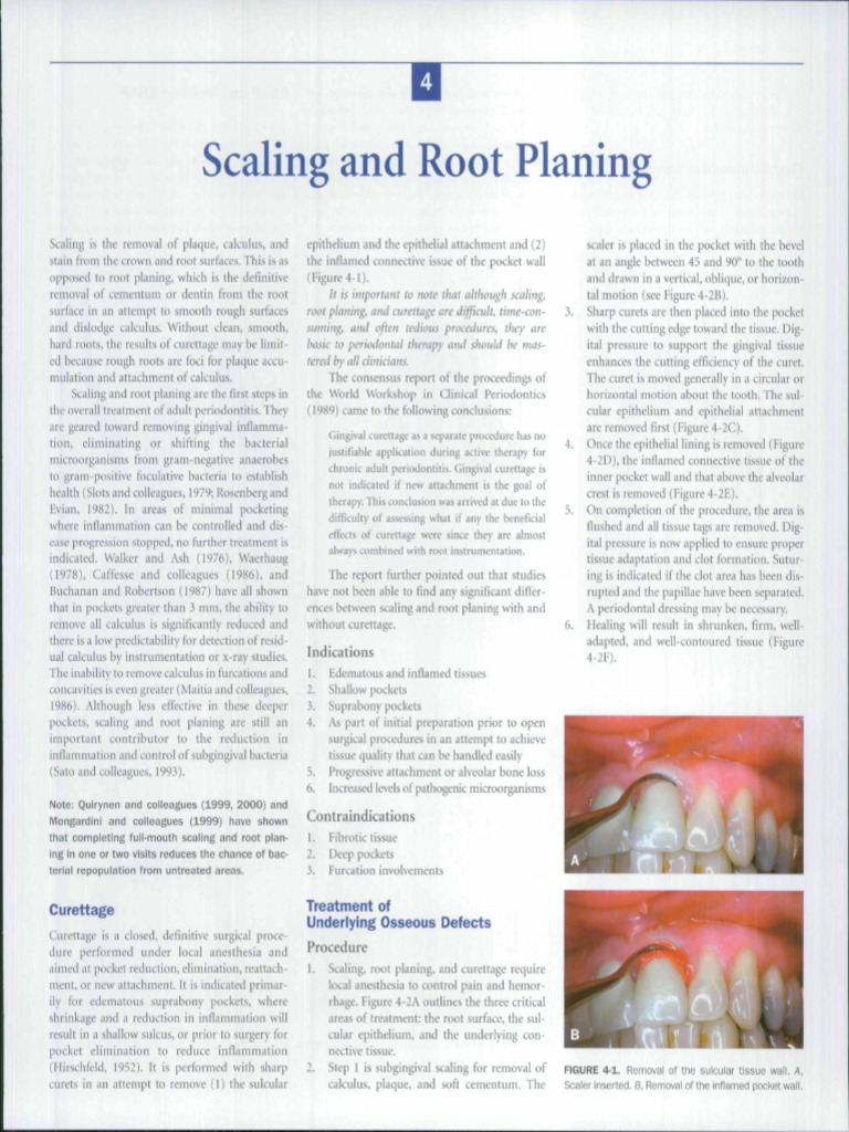 Scaling and Root Planing | PDF | Periodontology | Dentistry Branches