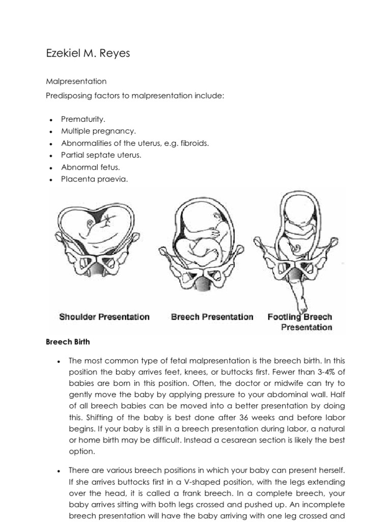 Malpresentation | PDF | Wellness