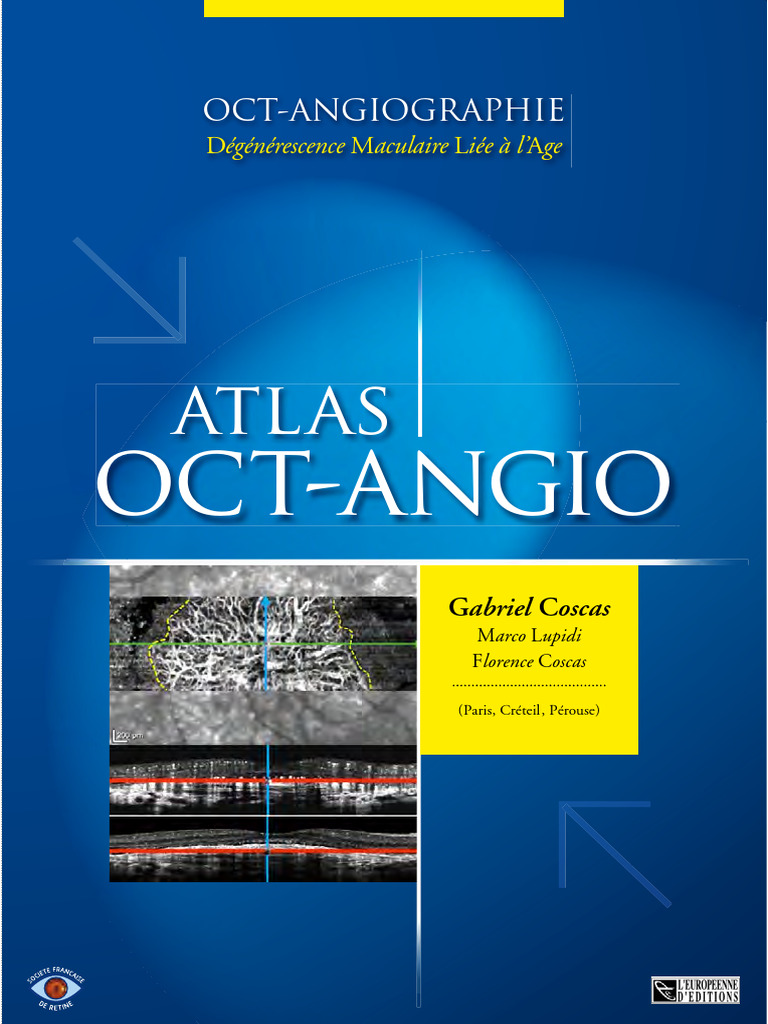 OCT-Angiographie et DMLA : Guide Complet | PDF | Rétine | Artère