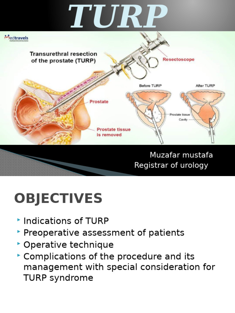 TURP | PDF | Causes Of Death | Medicine