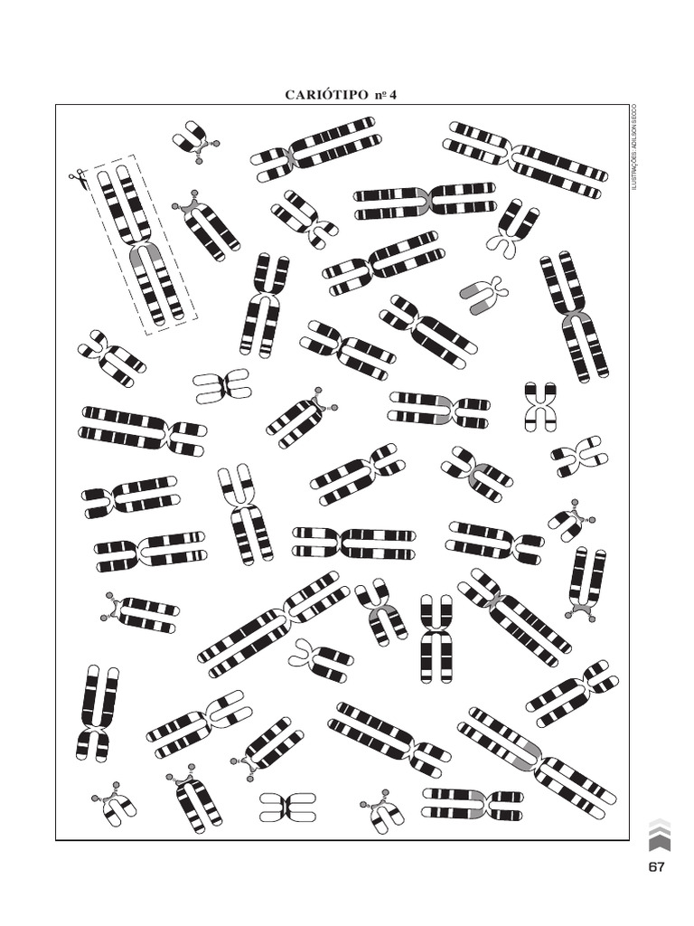 Cariótipo 4 - Síndrome de Klinefelter | PDF