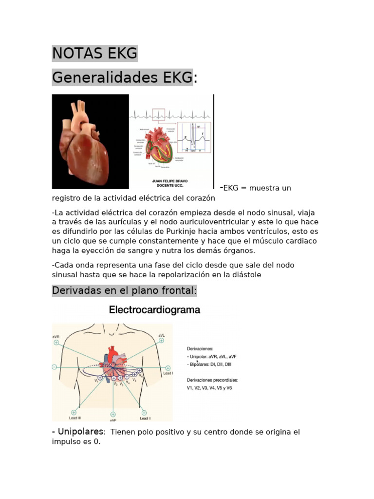 Interpretación y Análisis de EKG | PDF | Electrocardiografia | Infarto ...
