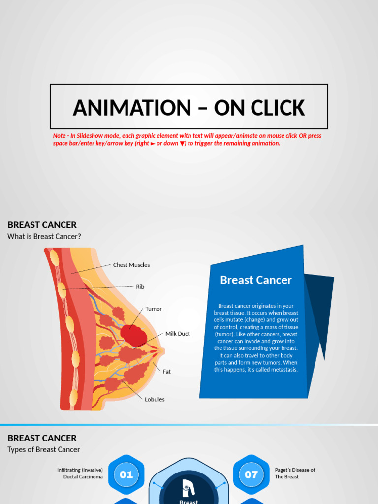 Breast Cancer Animated 16x9 | PDF | Breast Cancer | Cancer