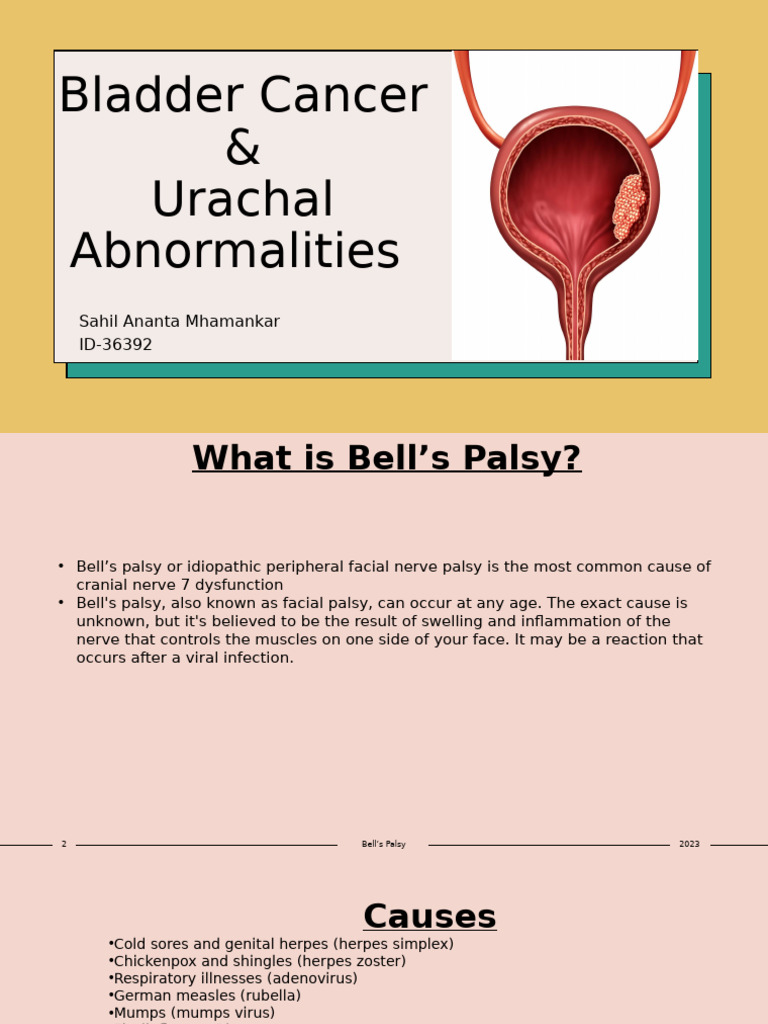 Bell’s Palsy | PDF | Immunology | Human Diseases And Disorders