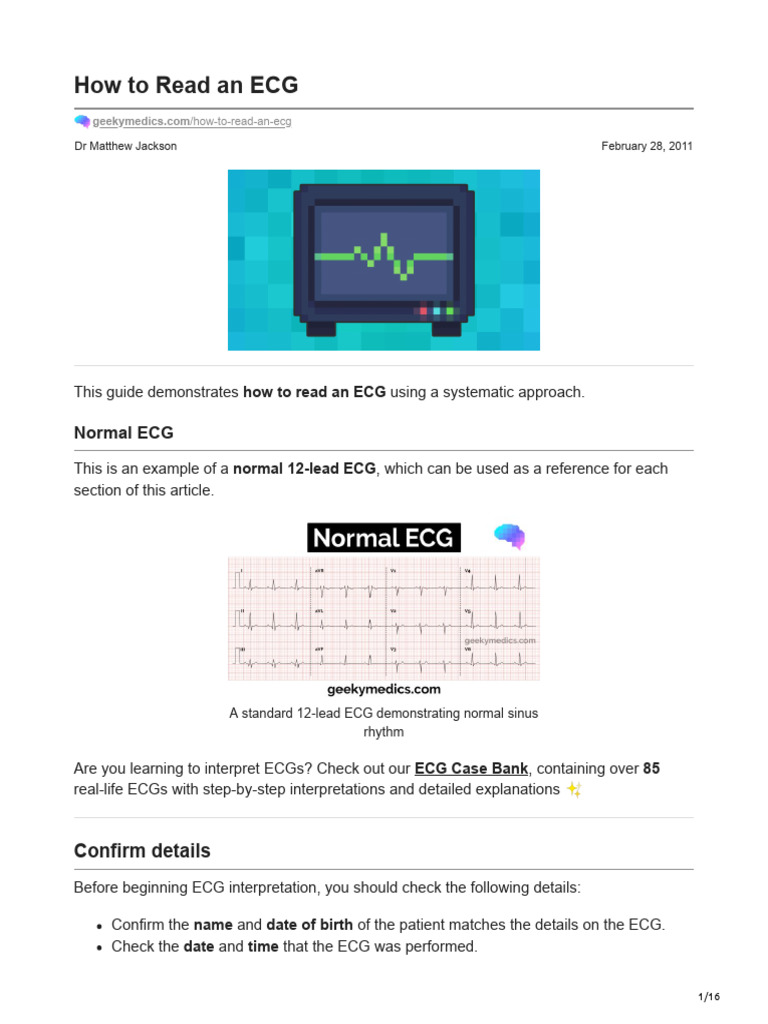 How To Read An ECG | PDF | Electrocardiography | Circulatory System