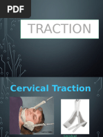 Mechanical Traction Techniques in Physiotherapy | PDF | Vertebral ...