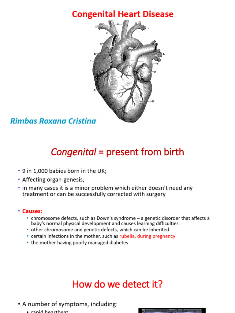 C28. Bolile Cardiace Congenitale - Roxana Rimbas | PDF | Congenital ...
