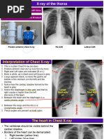 RTOG Heart Contouring Atlas | PDF | Heart | Atrium (Heart)