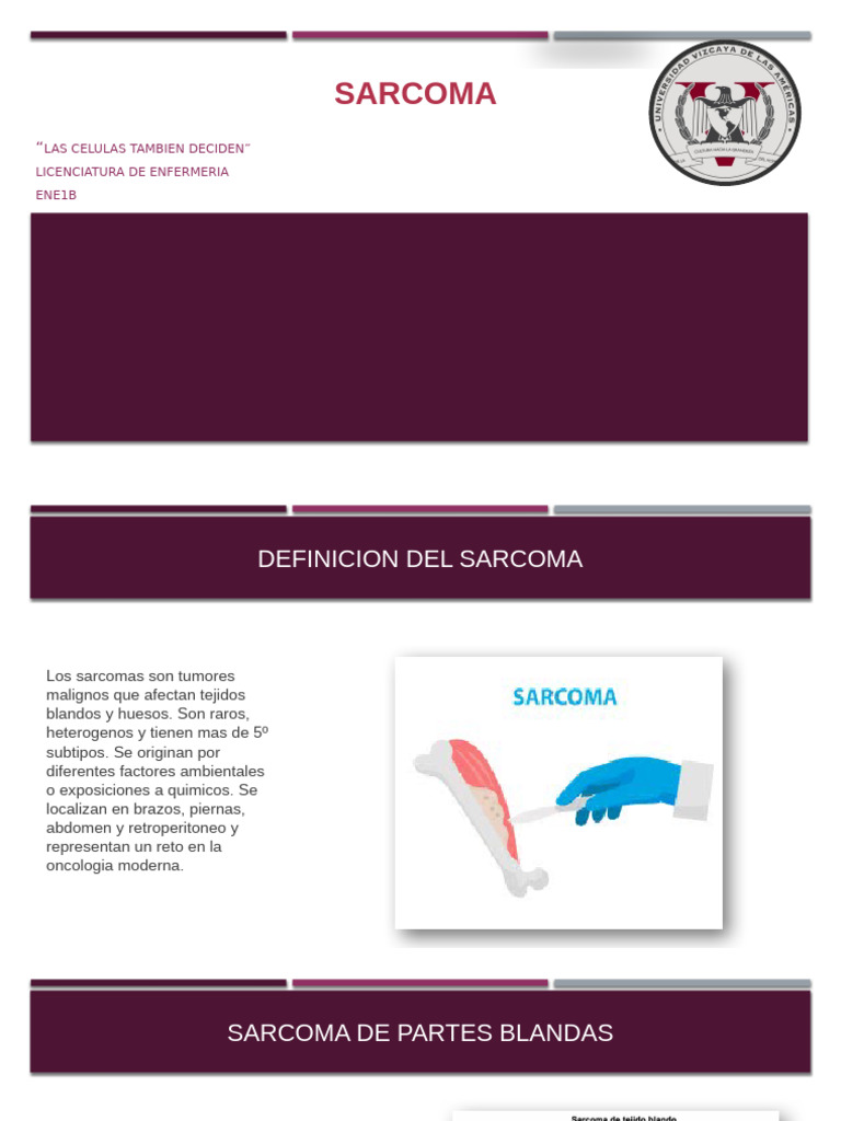 Definición y características del sarcoma | PDF | Sarcoma | Cáncer