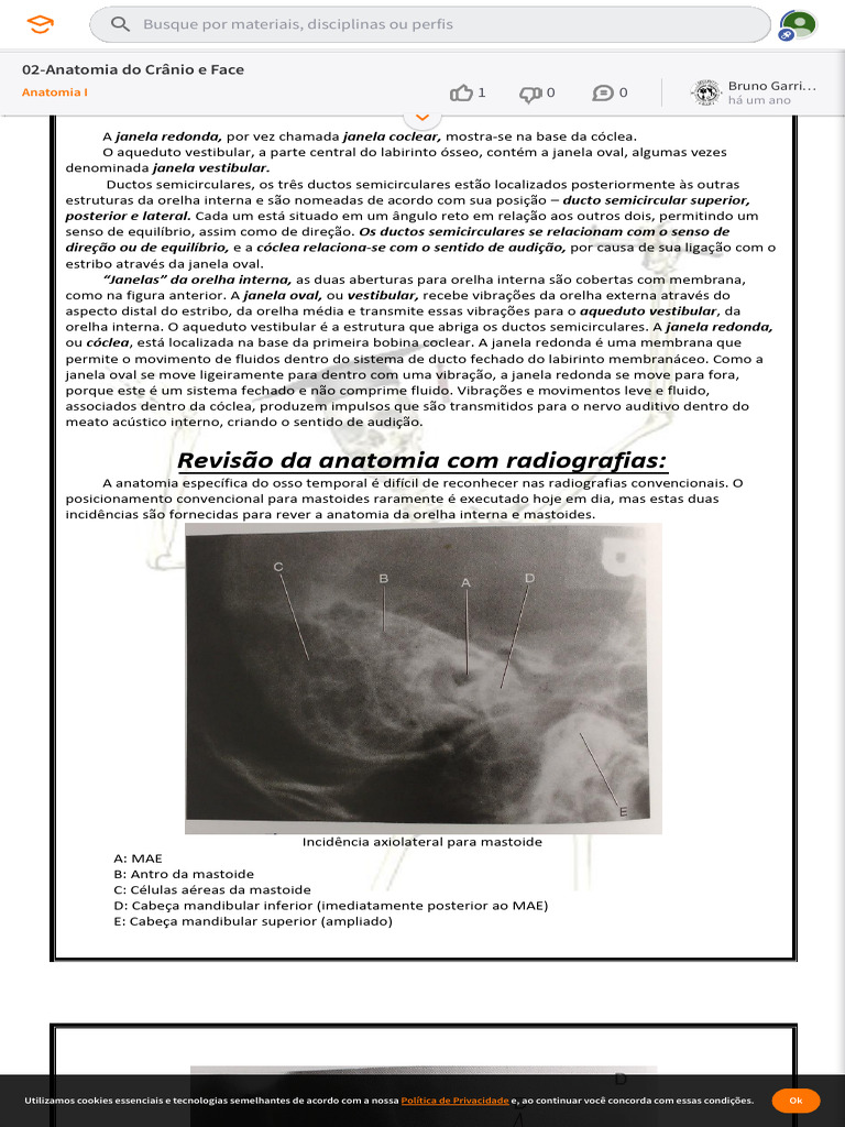 Anatomia do Labirinto Ósseo e Audição | PDF | Orelha | Audição