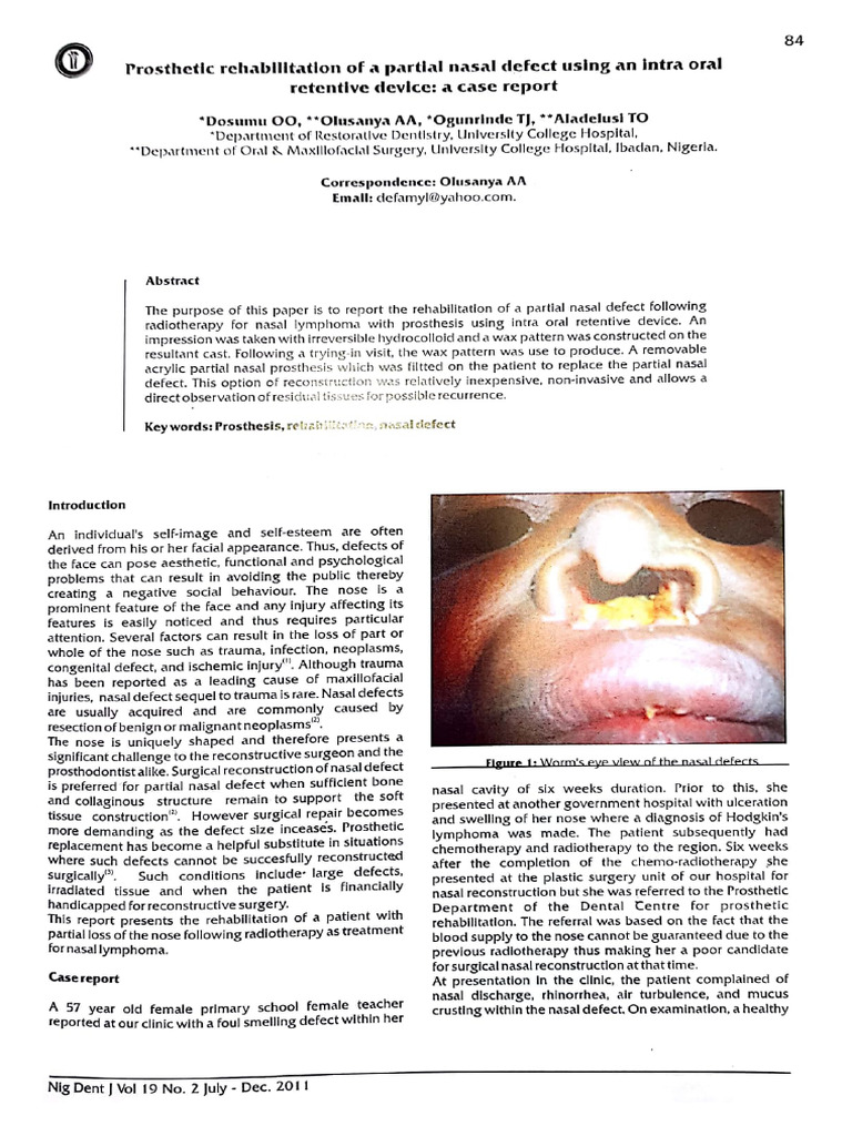 Prosthetic Rehabilitation of A Partial Nasal Defect Using An Intra Oral ...