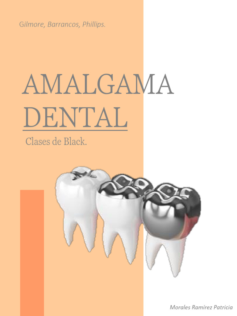 Amalgama Dental: Composición y Propiedades | PDF | Mercurio (Elemento ...