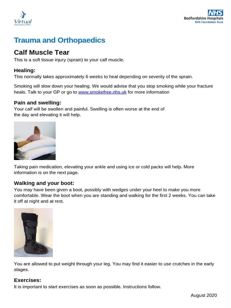 Calf Muscle Tear Recovery Guide | PDF | Foot | Edema