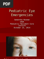 Lid Parallel Conjunctival Folds (LIPCOF) | PDF | Optics | Ophthalmology