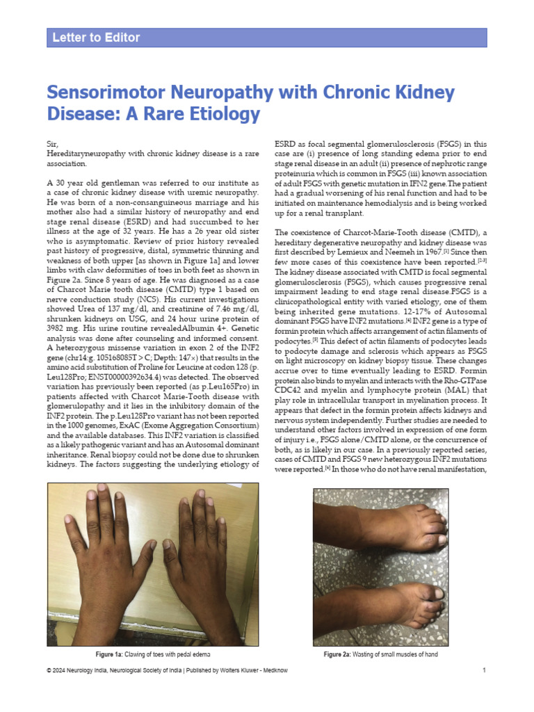Sensorimotor Neuropathy With Chronic Kidney.21 | PDF | Nephrology | Kidney