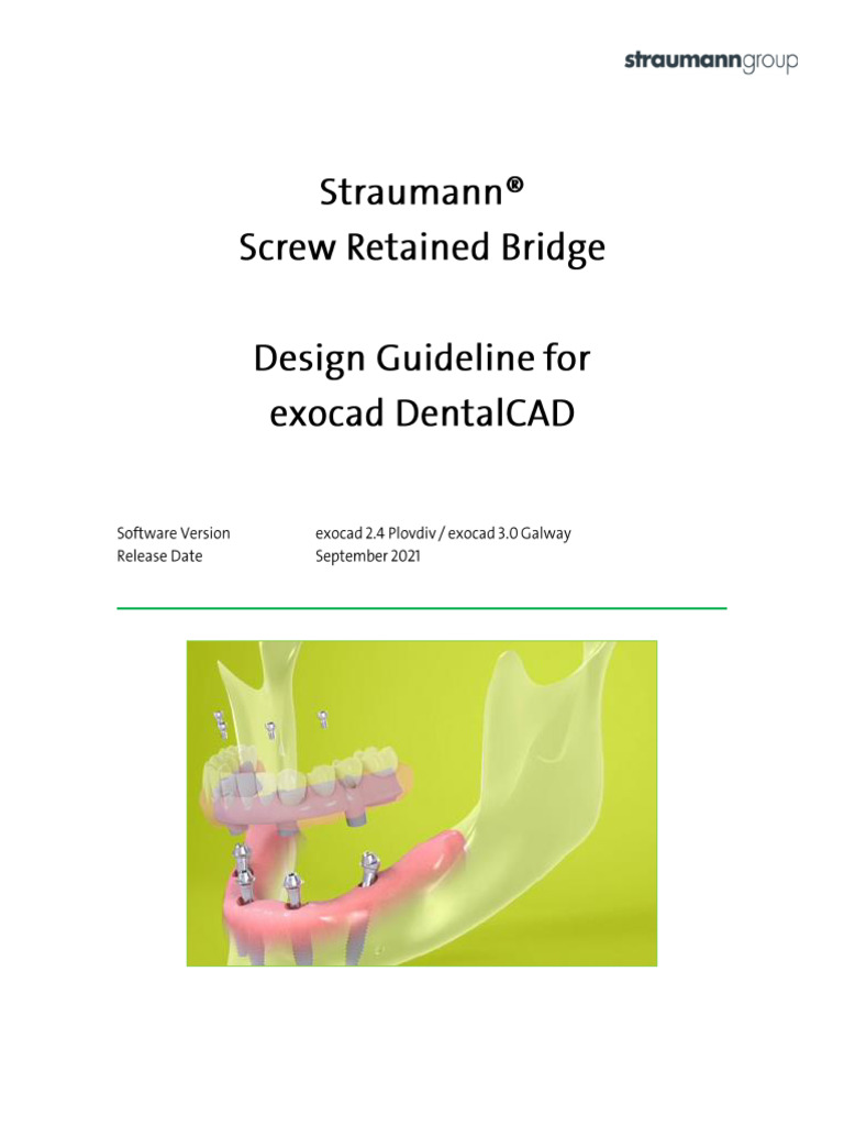 Exocad SRBB Design Guide EN | PDF