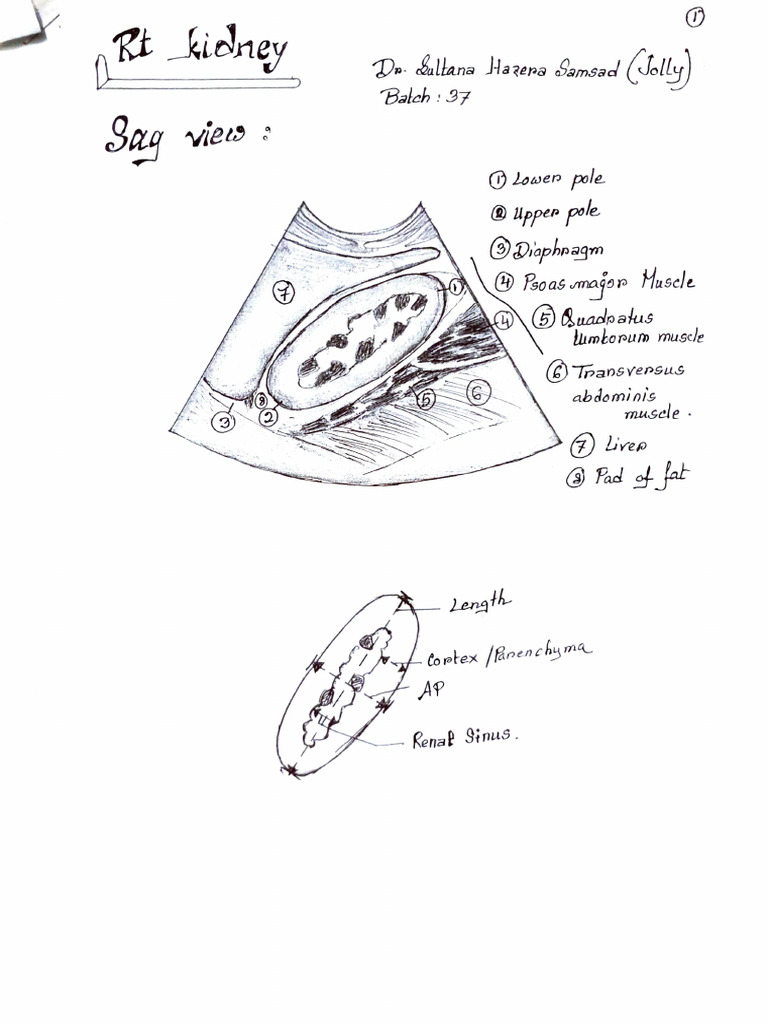 Rt Kidney | PDF