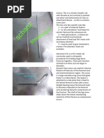 AO Plating Basics (Brief) | PDF | Stress (Mechanics) | Bending