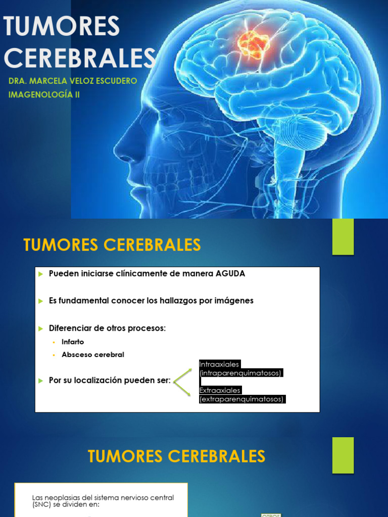 Clase 2 - TUMORES CEREBRALES | PDF | Tumor cerebral | Neoplasias