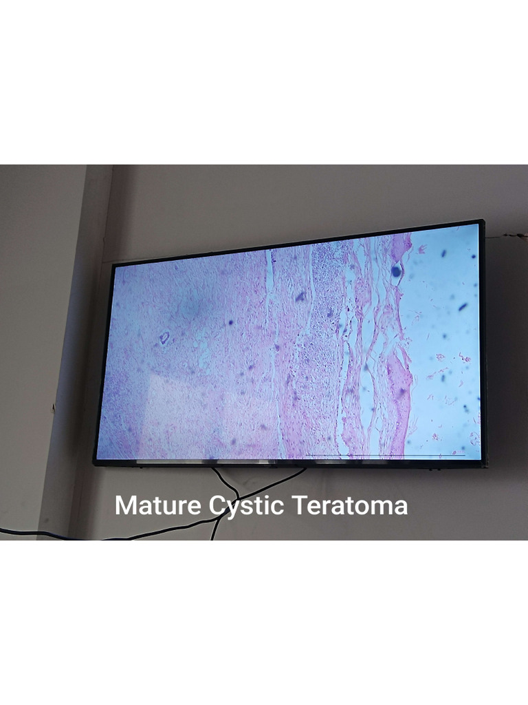 Slides and Specimens of Female Genital Tract and Breast. | PDF