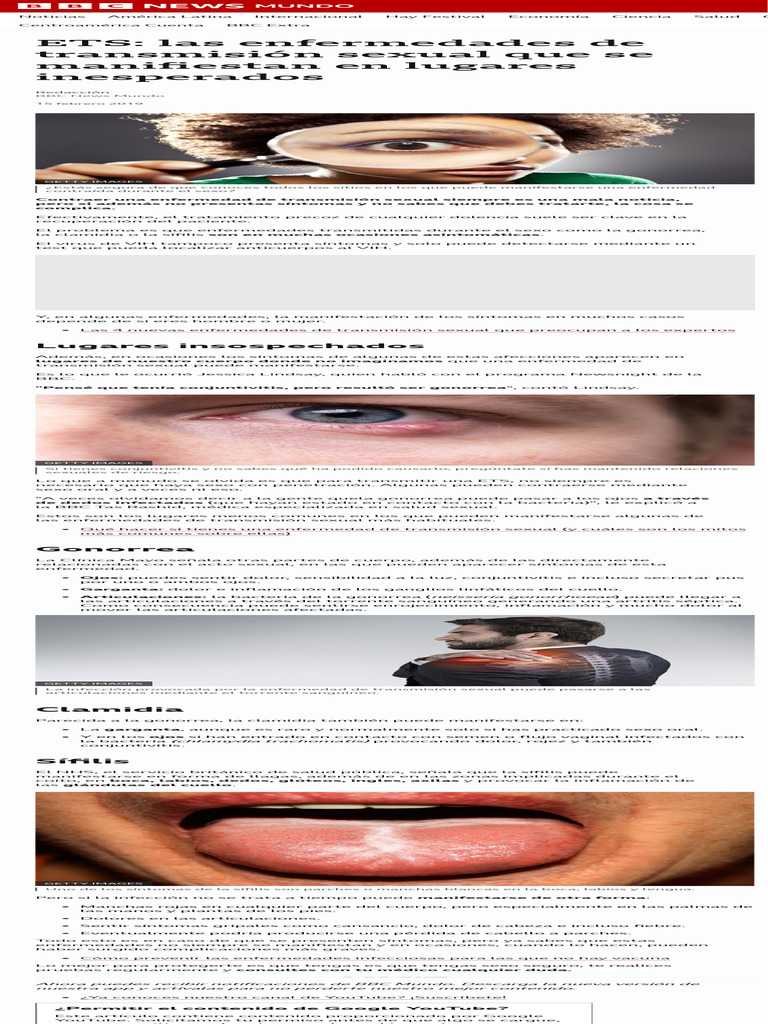 ETS las enfermedades de transmisión sexual que se manifiestan en lugares inesperados - BBC News ...