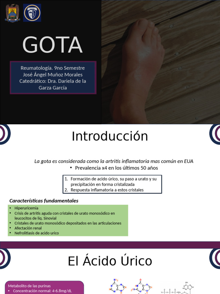 Gota | PDF | Gota | Inflamación