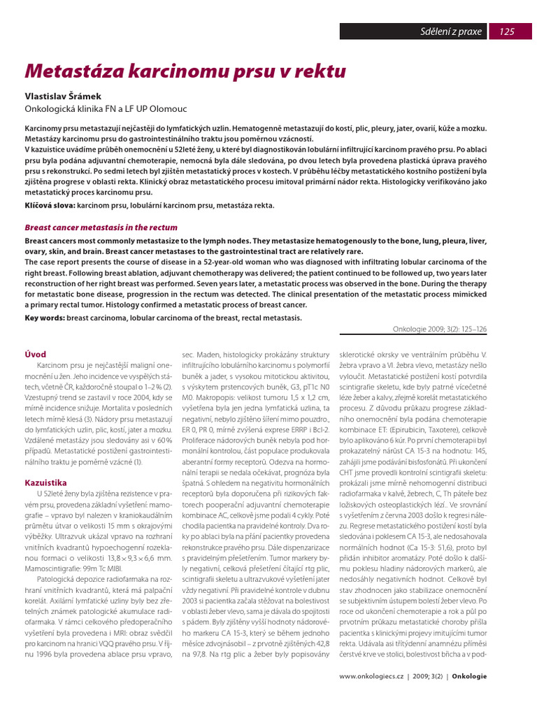 Solen - Xon 200902 0014 | PDF