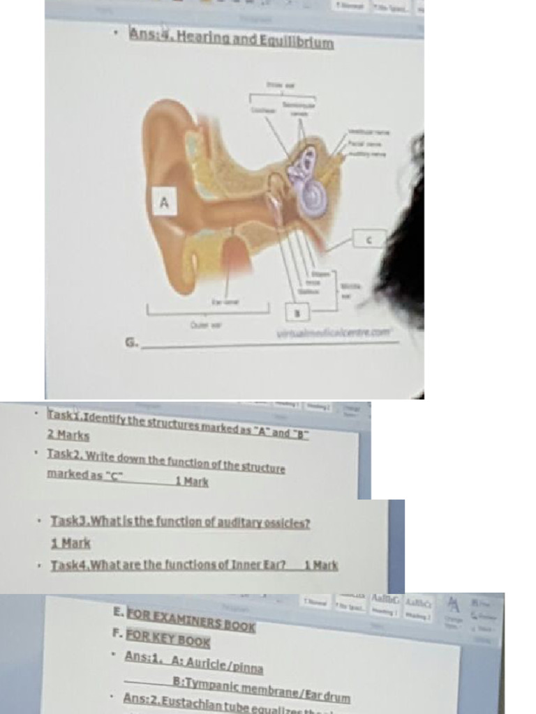 lcmd physio ospe | PDF