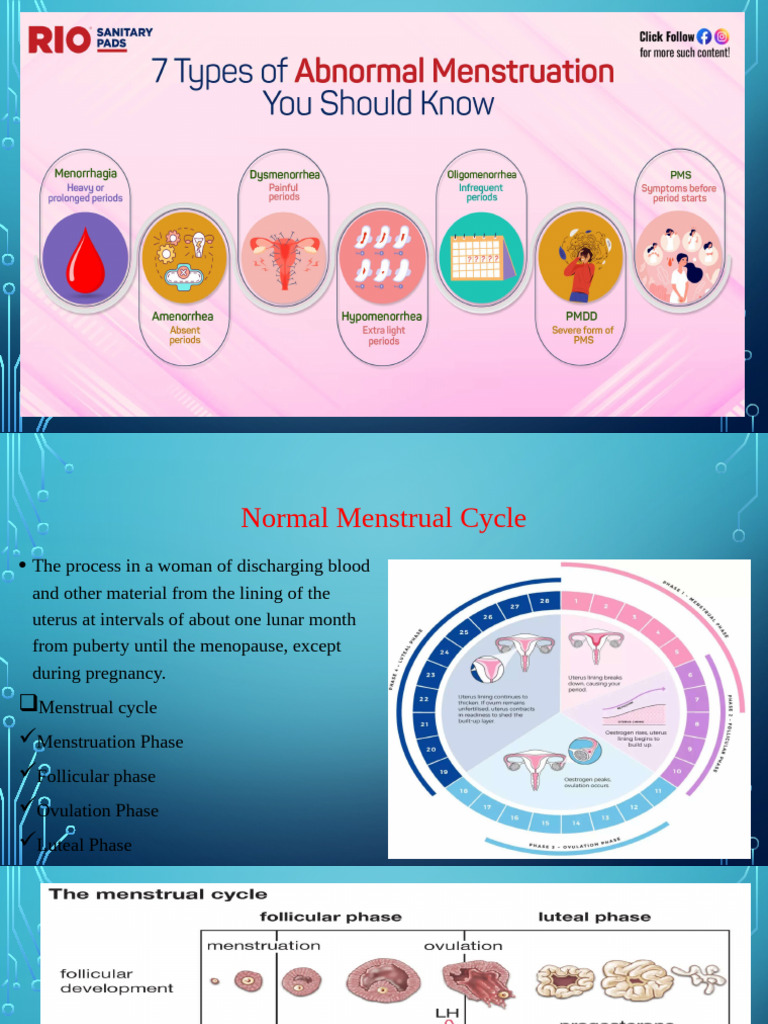 Menstrual Disorders V | PDF | Menstruation | Premenstrual Syndrome