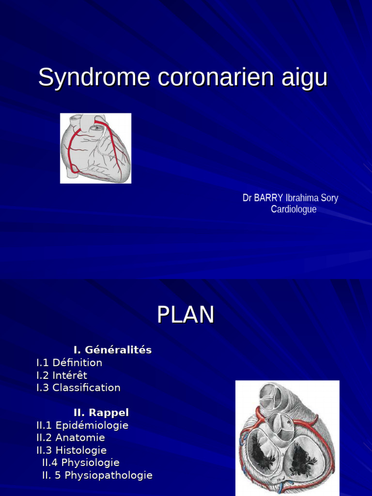 Comprendre le syndrome coronarien aigu | PDF | Infarctus du myocarde | Cœur