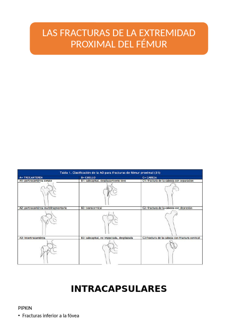 Fracturas de Fémur: Clasificación y Tipos | PDF