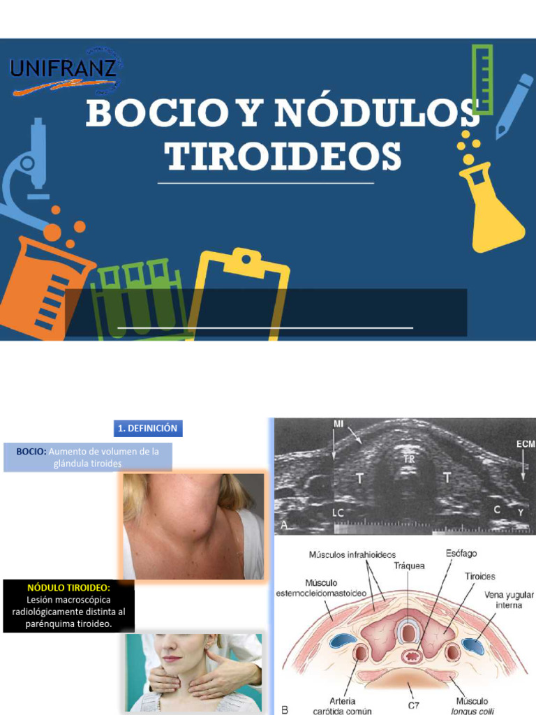 Bocio y Nódulos Tiroideos: Guía Completa | PDF | Tiroides | Sistema ...