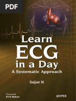 How To Read An ECG - ECG Interpretation - EKG - Geeky Medics | PDF ...