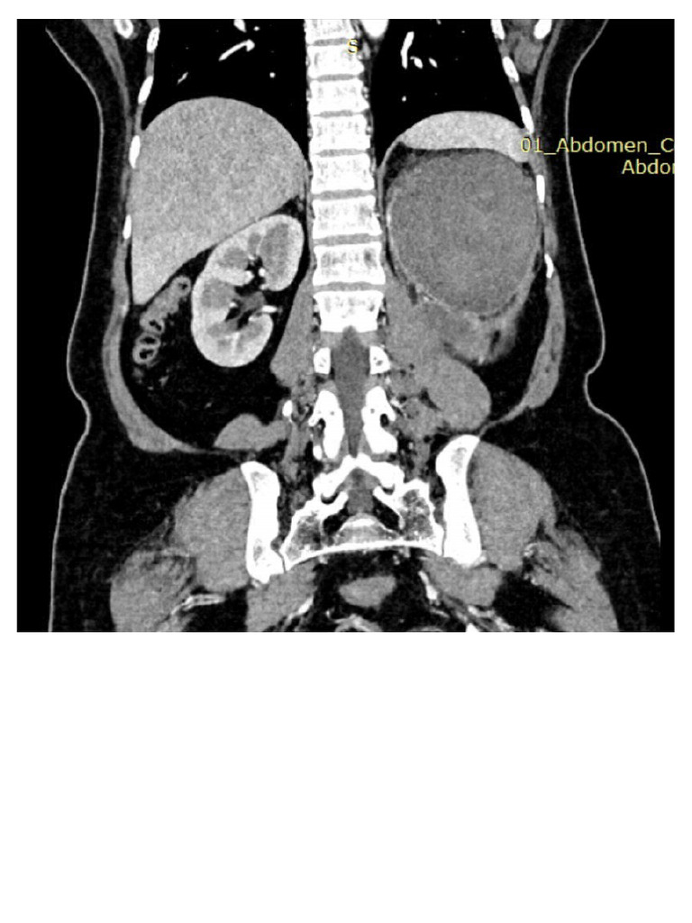 Gambar CT Scan | PDF