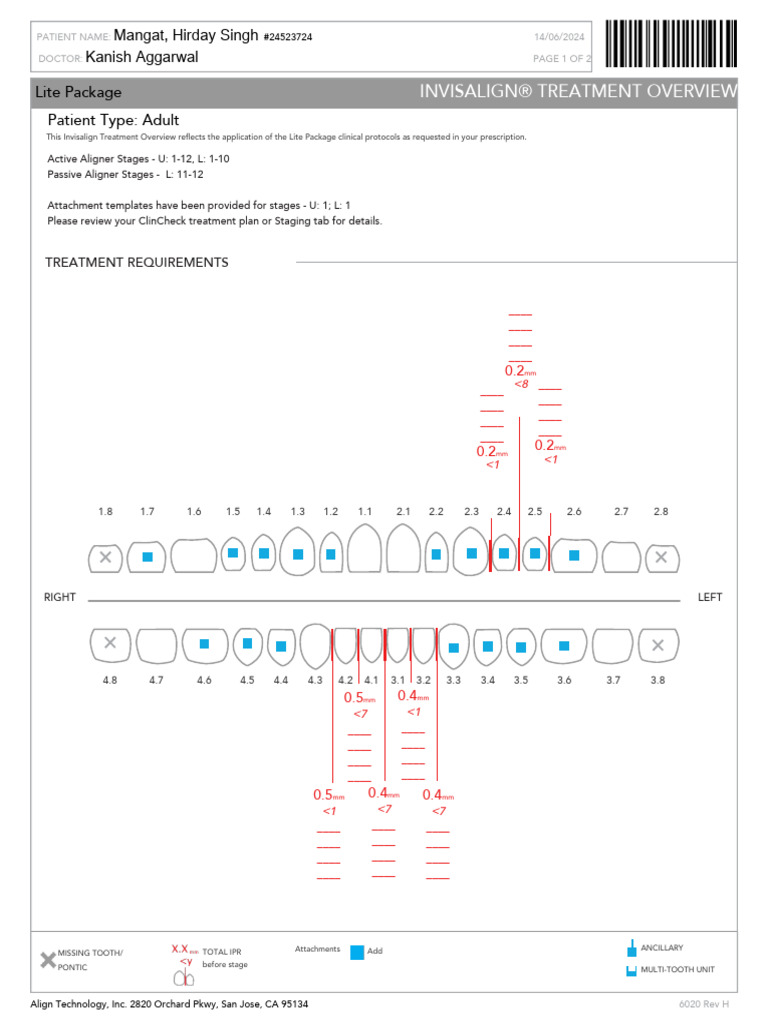 Invisalign® Treatment Overview: Mangat, Hirday Singh Kanish Aggarwal ...
