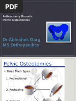 Sarmiento Cast for Tibial Fractures | PDF