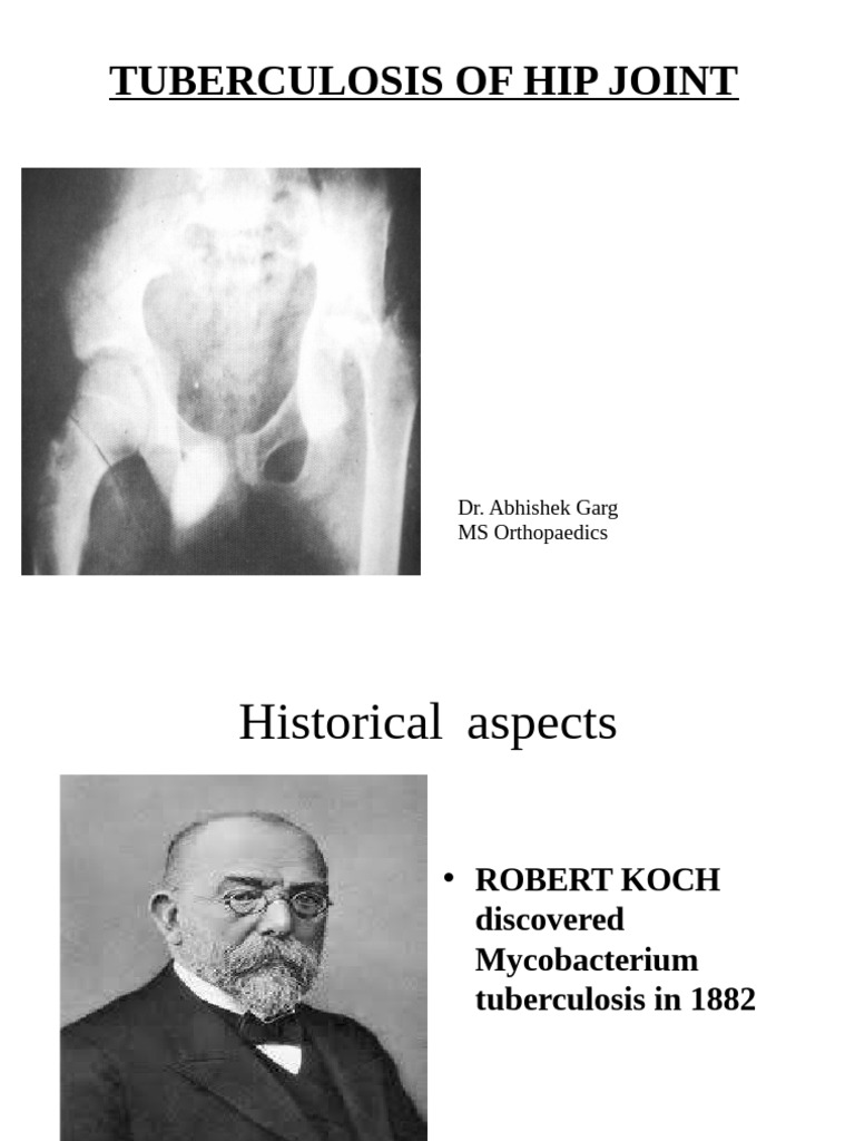 Stages of Tuberculosis in the Hip | PDF | Hip | Anatomical Terms Of Motion